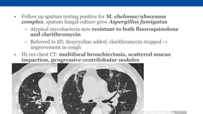 Understanding The "Spectrum" Of Disease: A Late Diagnosis of Cystic ...