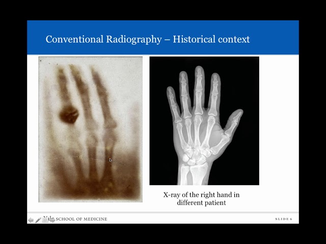Introduction to Radiology: Conventional Radiology