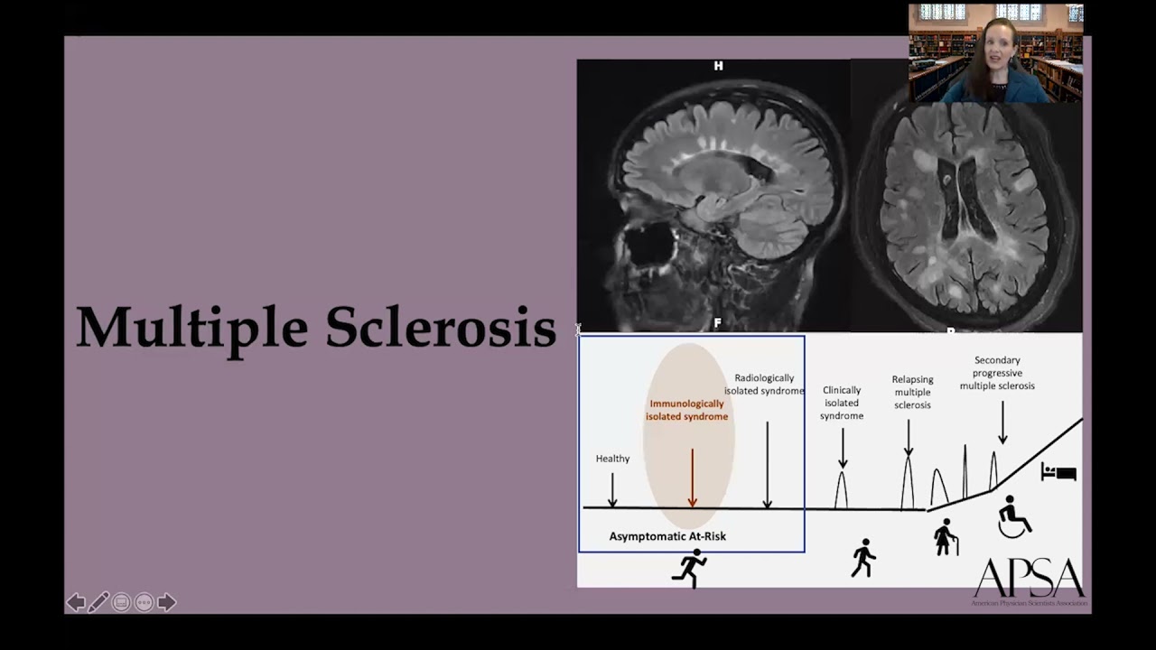 Supporting Physician Scientists - Multiple Sclerosis