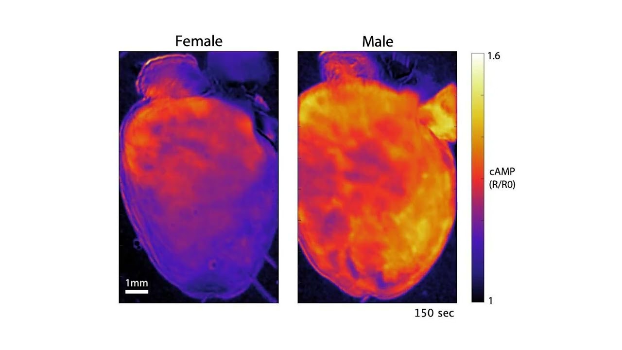 Female and Male Hearts Responding to the Stress Hormone Noradrenaline Female and Male Hearts Responding to the Stress Hormone Noradrenaline