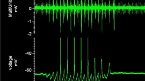Thalamocortical cells during spindle waves