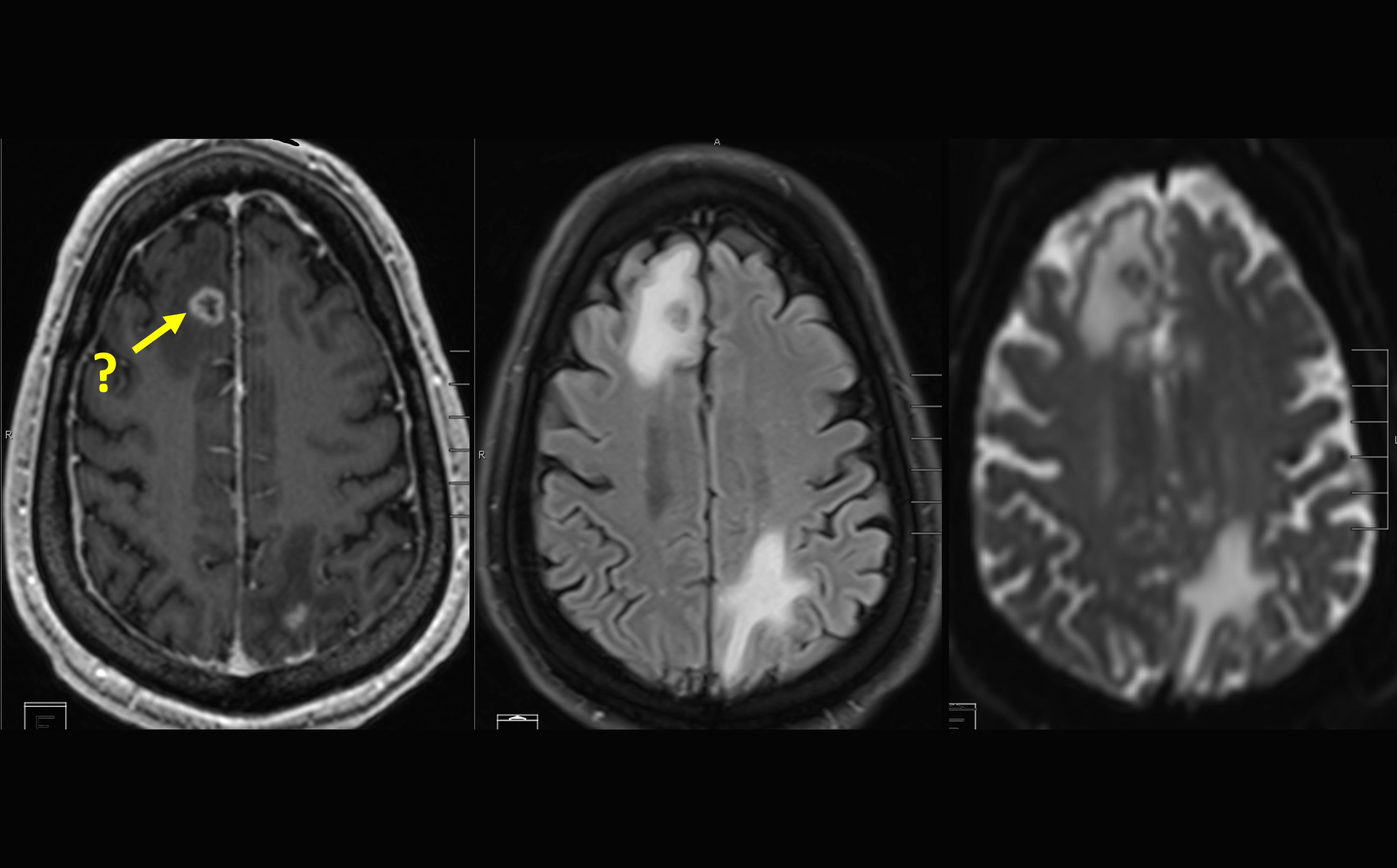 Radiologists Bring New Molecular Imaging Technology to Yale