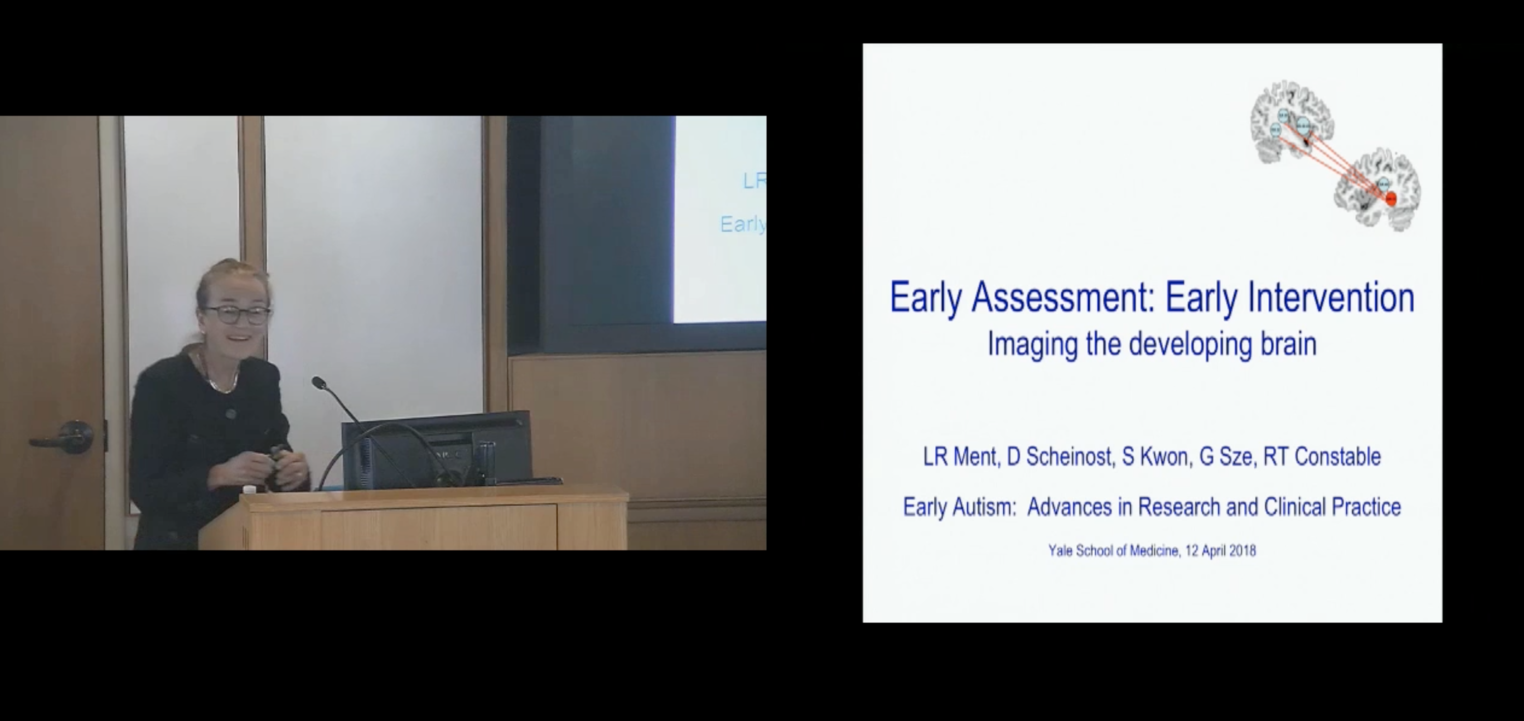 Early Assessment: Early Intervention Imaging the developing brain Early Assessment: Early Intervention Imaging the developing brain