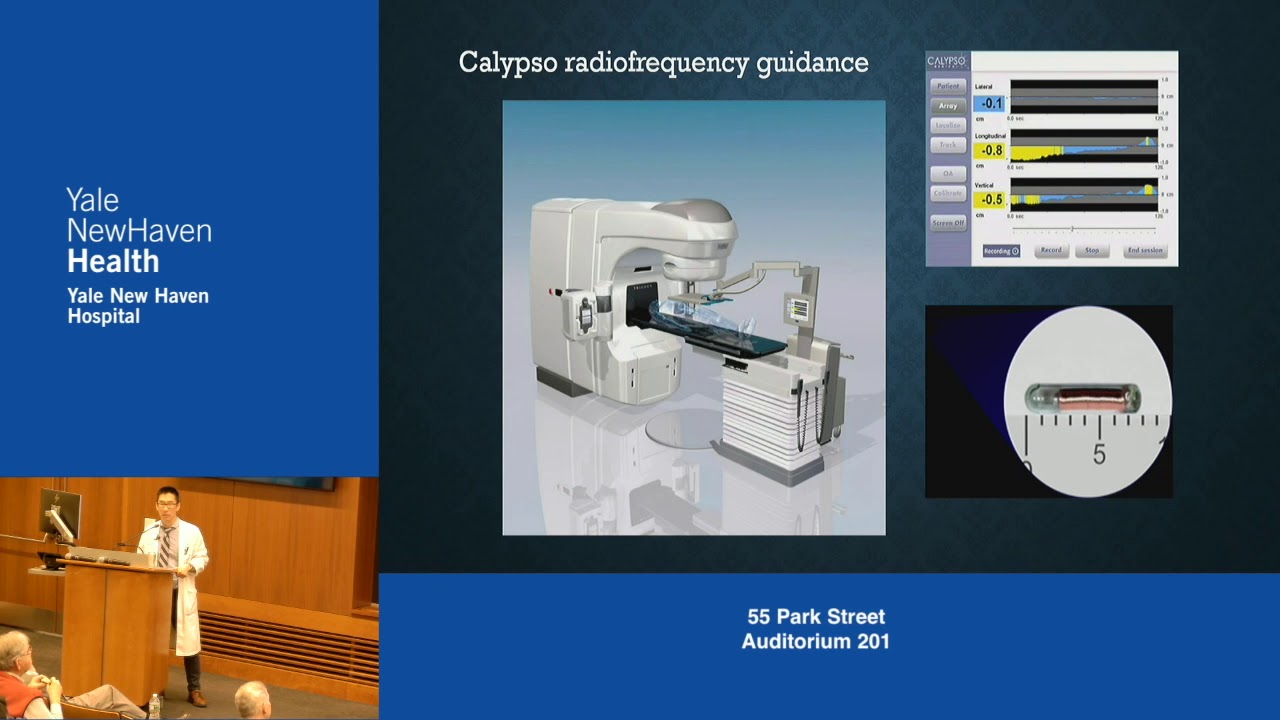Advances in Prostate Cancer Radiotherapy