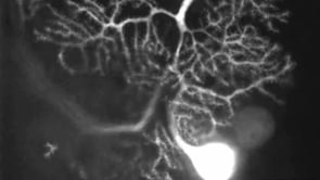 Purkinje Cell Dendrites