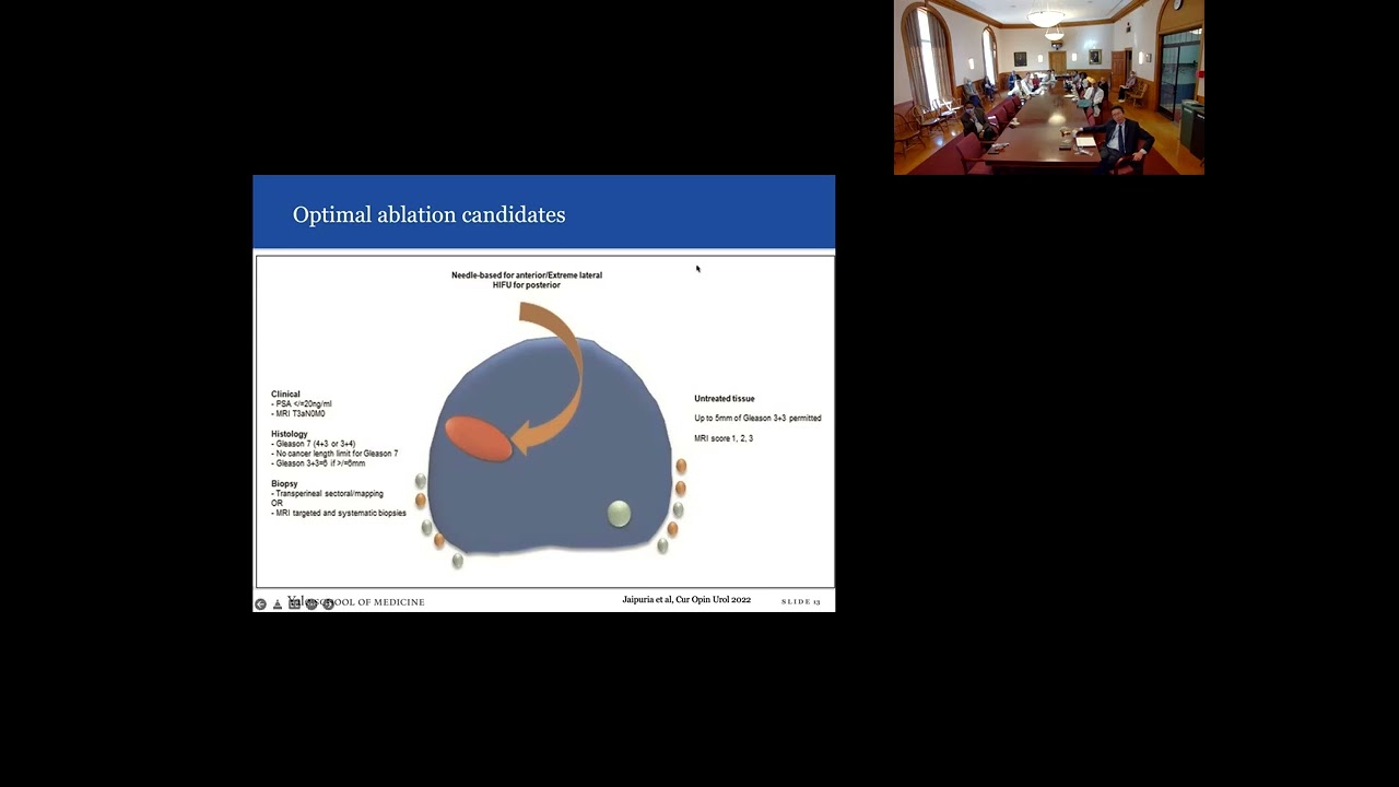 Yale Urology Grand Rounds - Prostate Cancer Ablation: Applications and ...