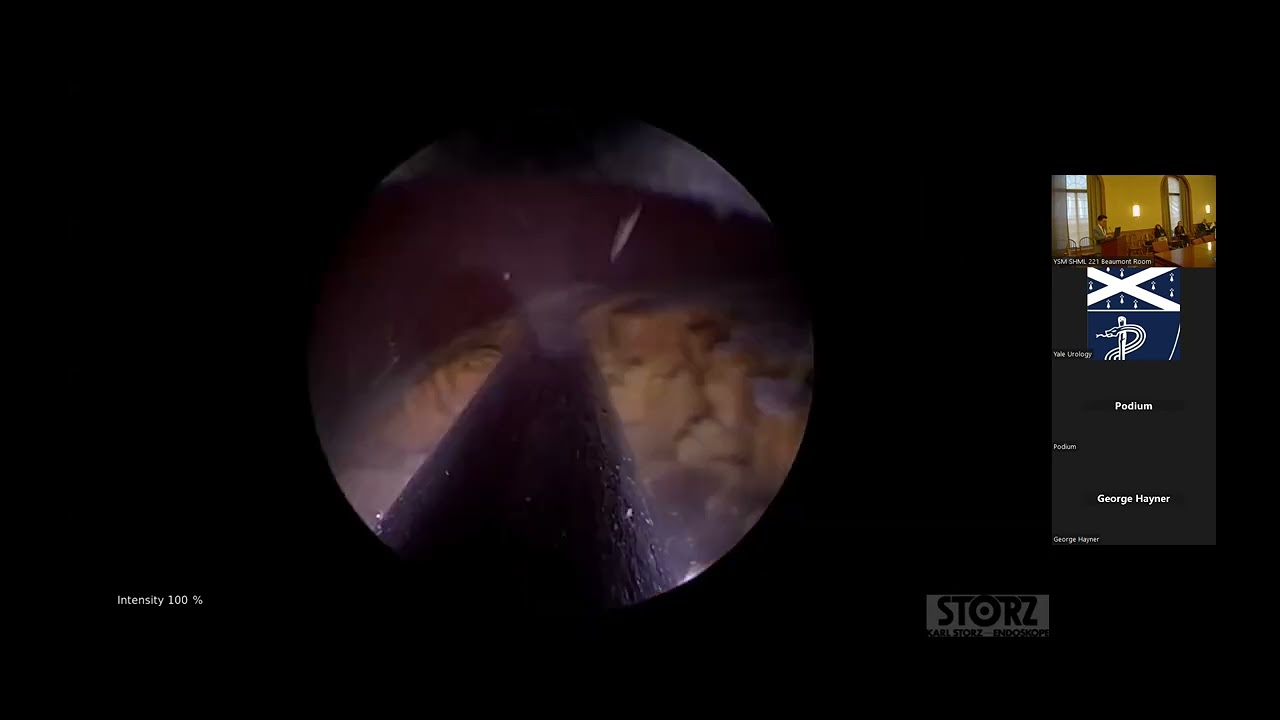 The Rise of the HoLEP Healers