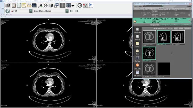 Synapse Clinical Tutorial
