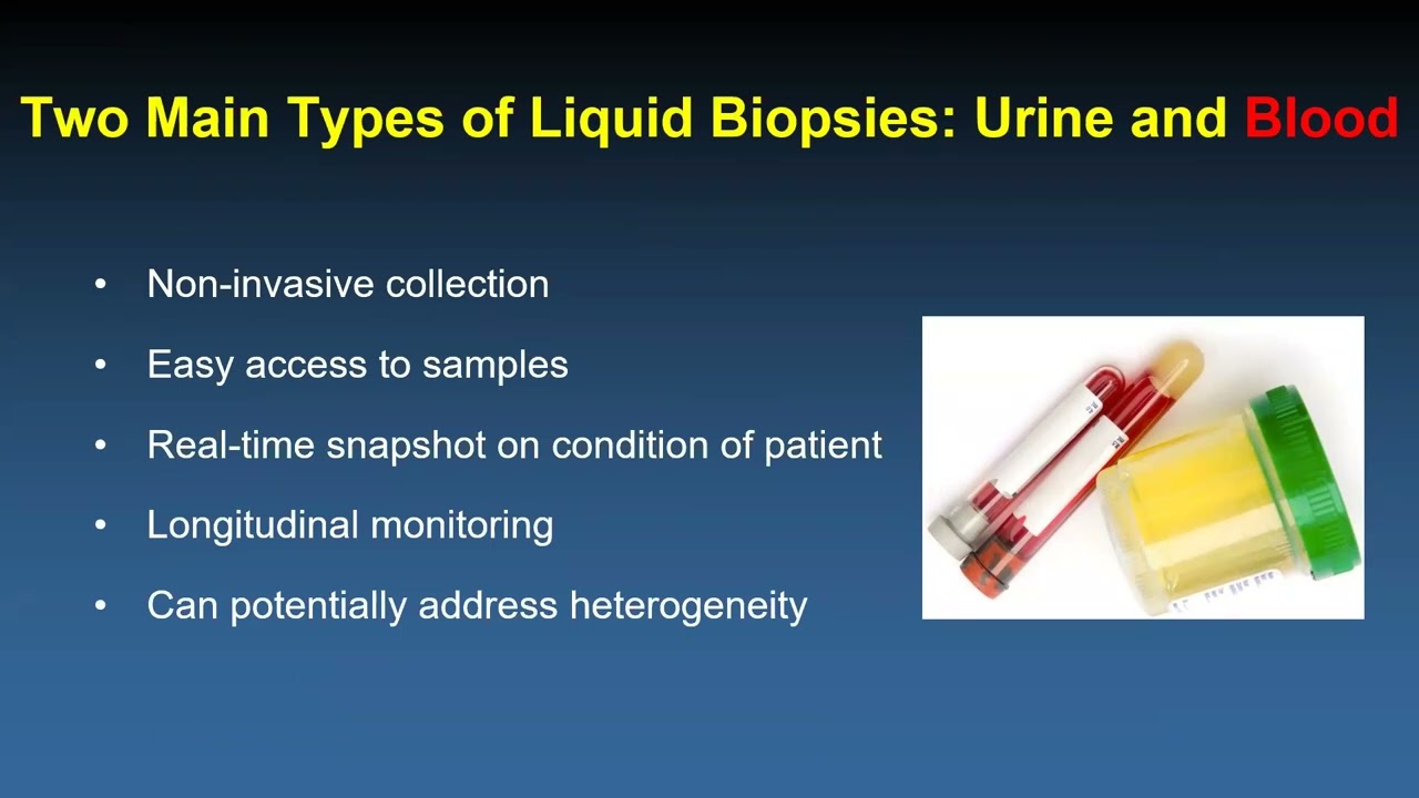 A Deep Dive in Liquid Biopsies for Non-Invasive Prostate Cancer Markers