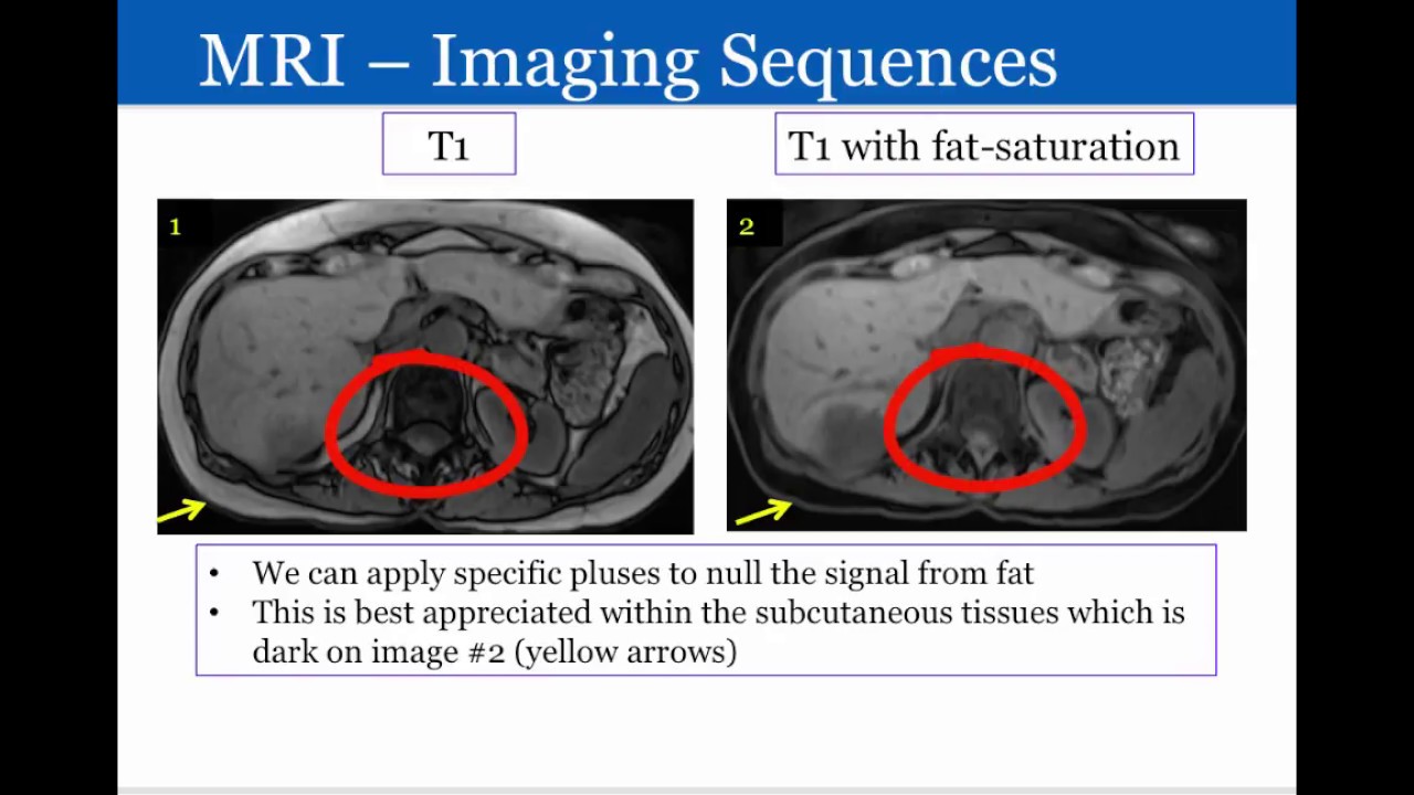 Introduction to Radiology: MRI