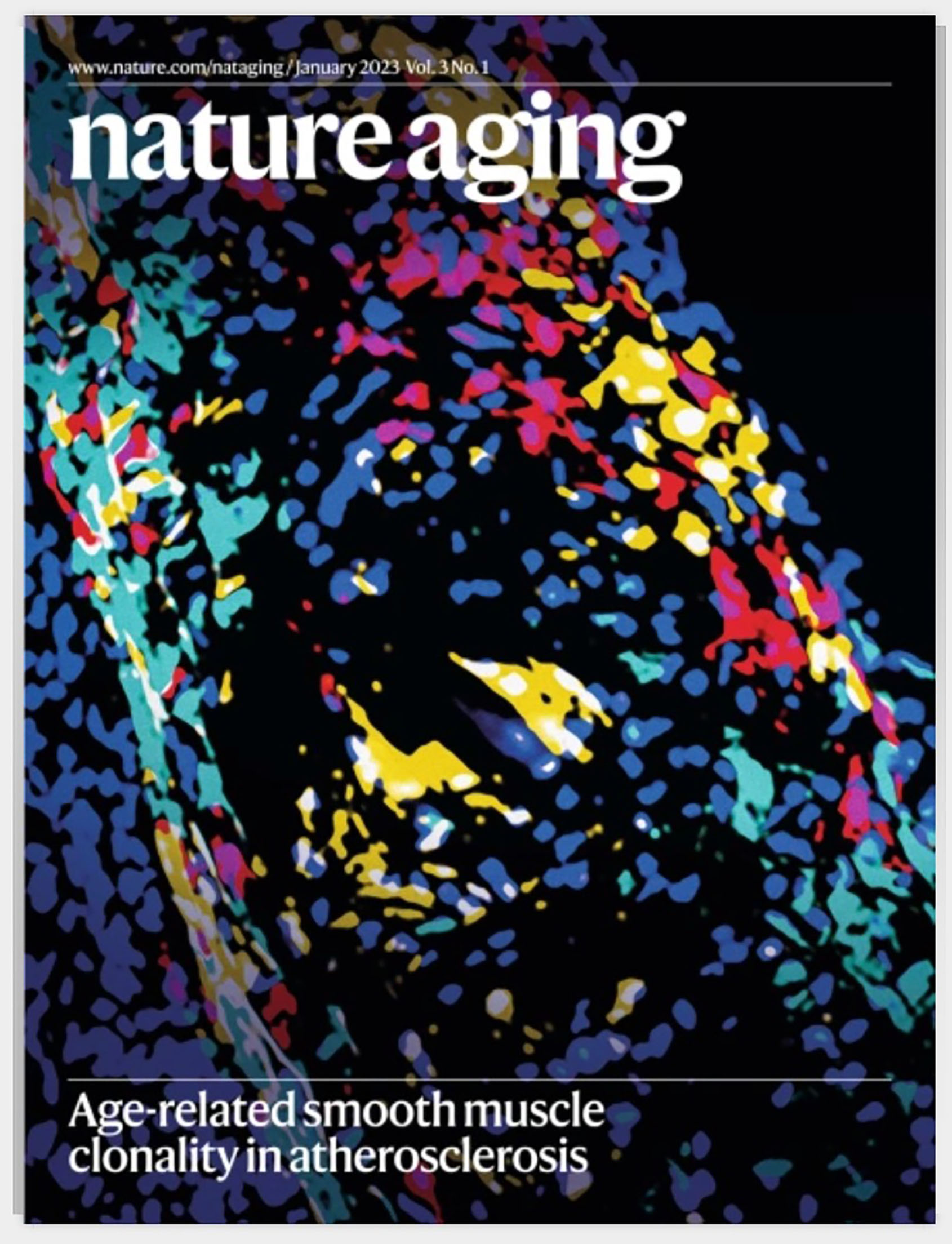 Yale Study Finds Aging of Bone Marrow Accelerates Atherosclerotic ...